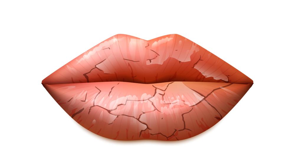 Images Of Unhealthy Lips | Lipstutorial.org